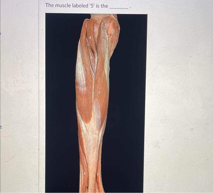 Solved The tendon labeled ' 3 ' represents a muscle in the | Chegg.com