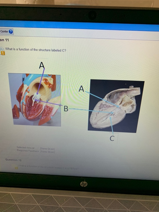 Solved If you had an oxygen molecule in the vessel labeled | Chegg.com