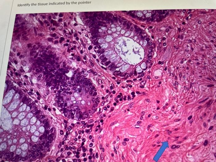 Solved Identify the tissue indicated by the pointer | Chegg.com