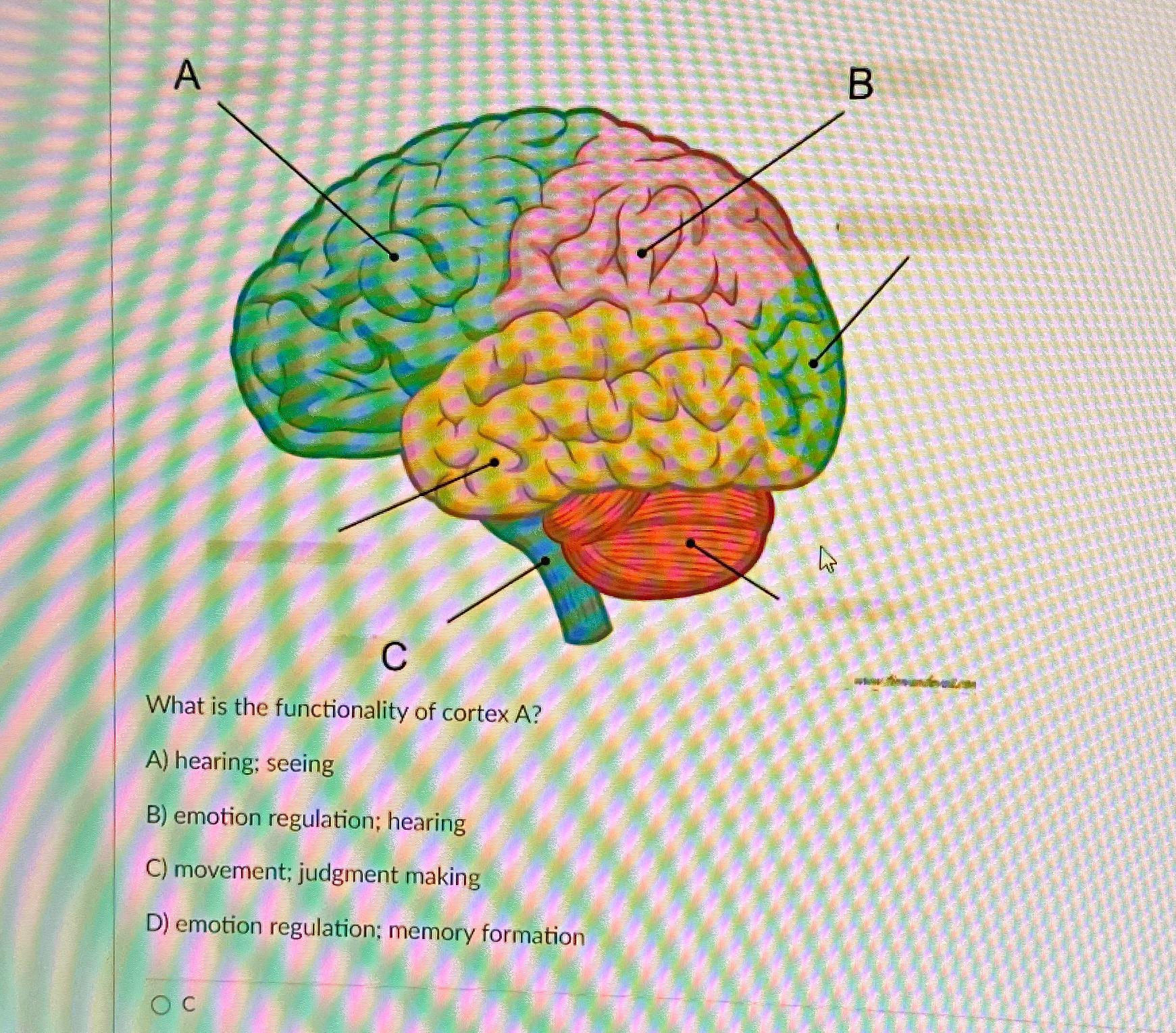 Solved AWhat is the functionality of cortex A ?A) ﻿hearing; | Chegg.com