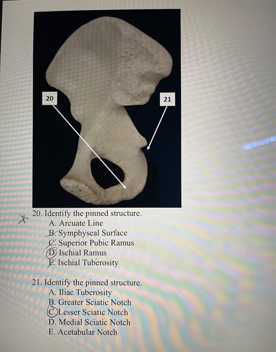 Solved 20 21 EDGE 20. Identify the pinned structure. * A. | Chegg.com