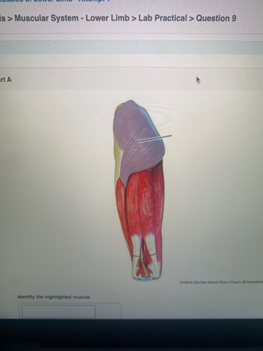 Solved Is > Muscular System - Lower Limb > Lab Practical > | Chegg.com