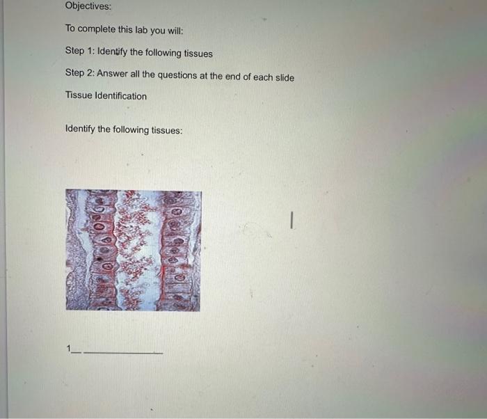 Solved 5. Transitional Epithelium8. cartilage 9. Connective | Chegg.com