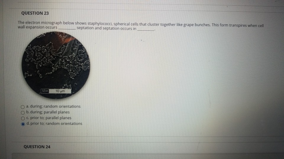 Solved QUESTION 23 The electron micrograph below shows | Chegg.com