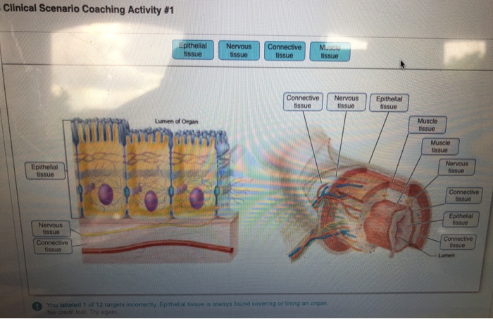 Solved Clinical Scenario Coaching Activity #1 Epithelial | Chegg.com