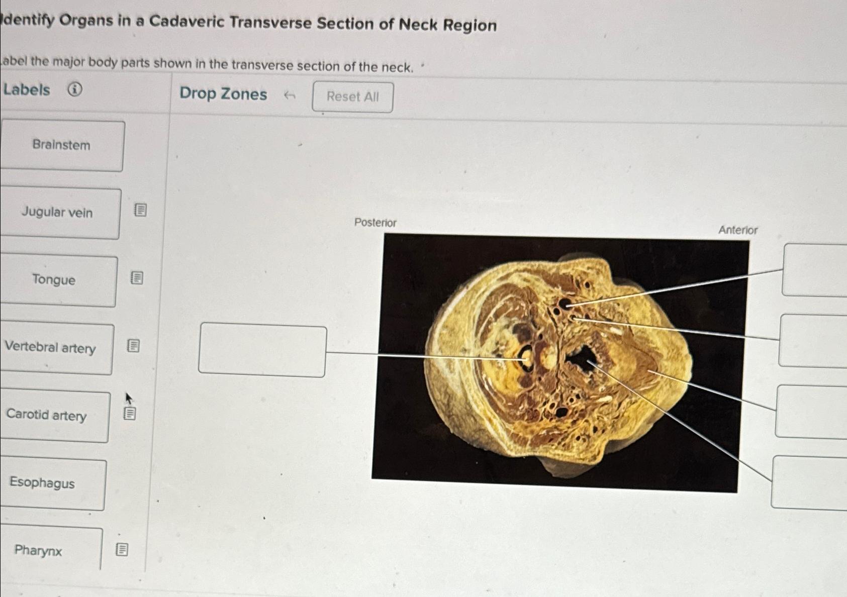 Solved Identify Organs in a Cadaveric Transverse Section of | Chegg.com