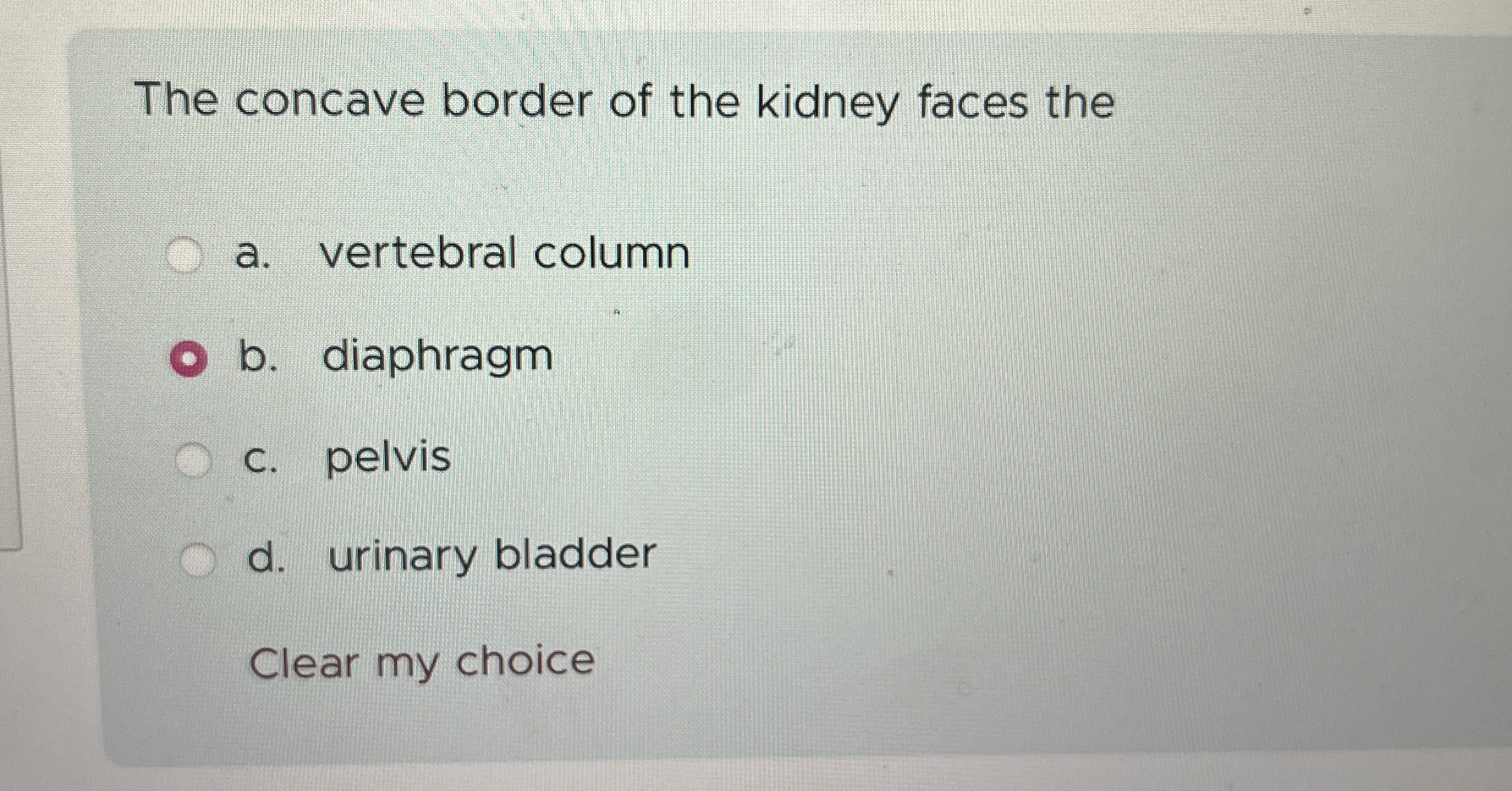Solved The concave border of the kidney faces thea. | Chegg.com