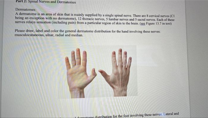 Solved Please draw, label and color the general dermatome | Chegg.com