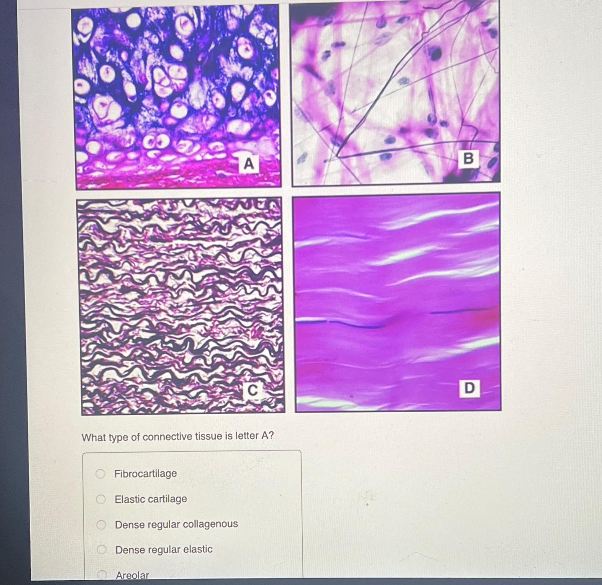 Solved What type of connective tissue is letter | Chegg.com
