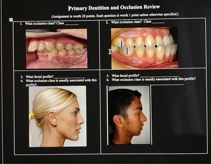 Solved Primary Dentition and Occlusion Review (Assignment | Chegg.com