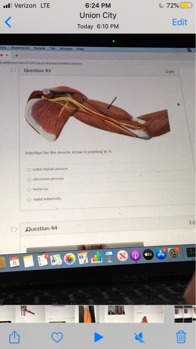 Solved The origin for the muscle arrow is pointing to is | Chegg.com