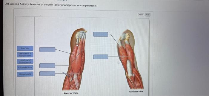 Solved Art-labeling Activity: Muscles of the Arm (anterior | Chegg.com