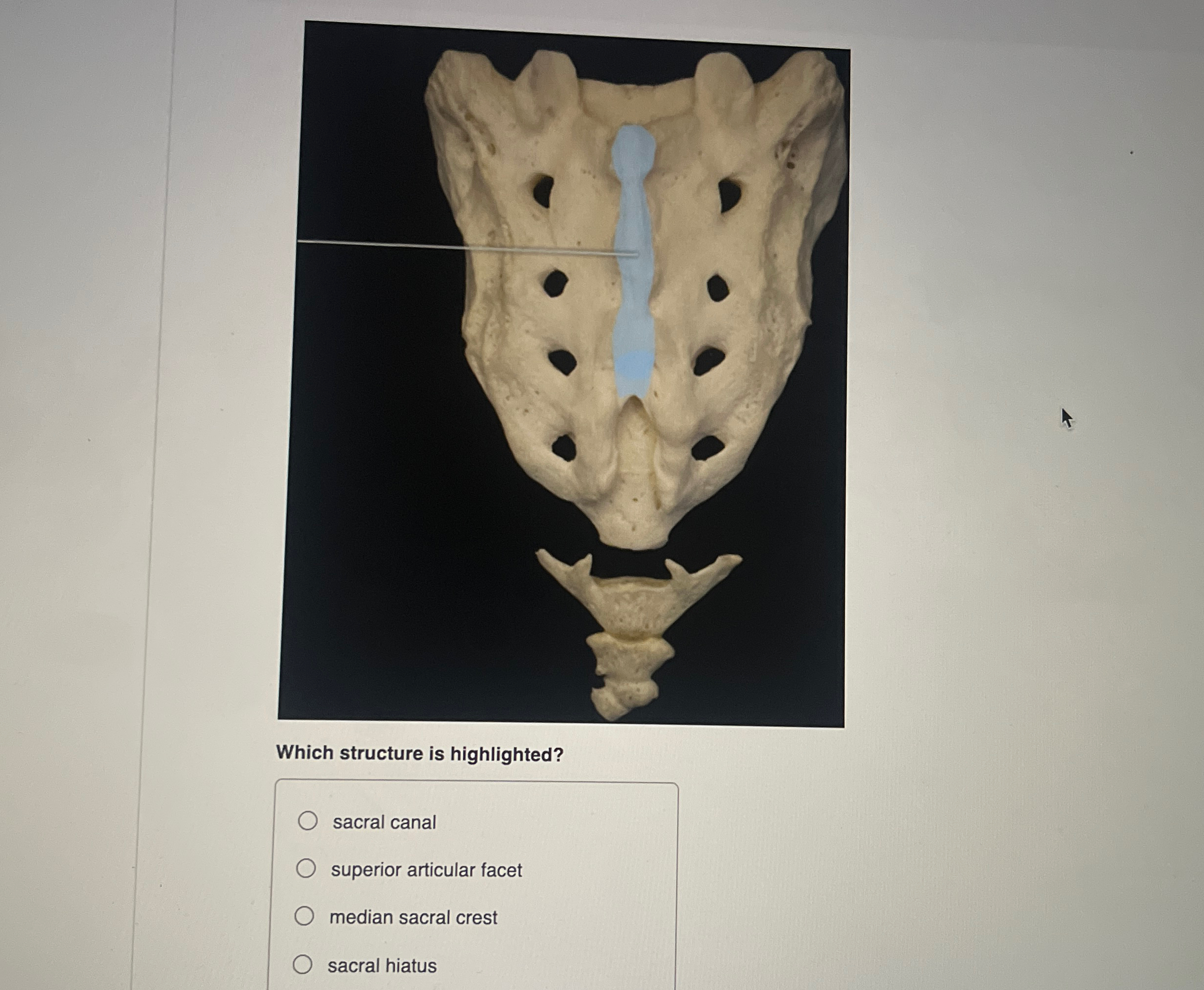 Solved Which structure is highlighted?sacral canalsuperior | Chegg.com