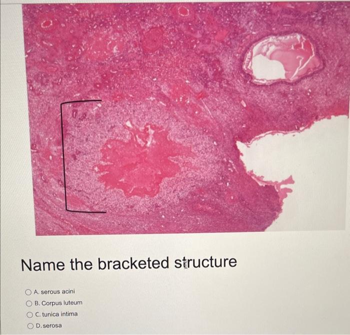Solved Name the bracketed structure A. serous acini B. | Chegg.com