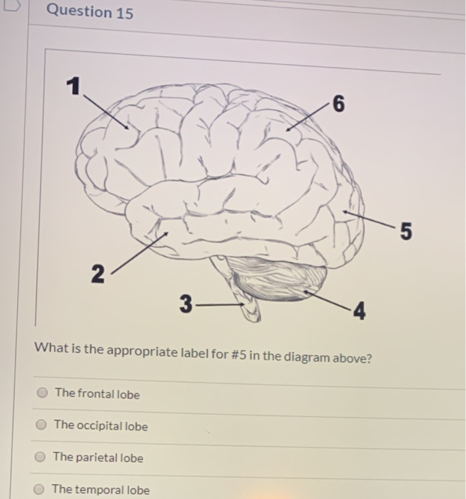 Solved Question 15 1 6 5 N 3 What is the appropriate label | Chegg.com