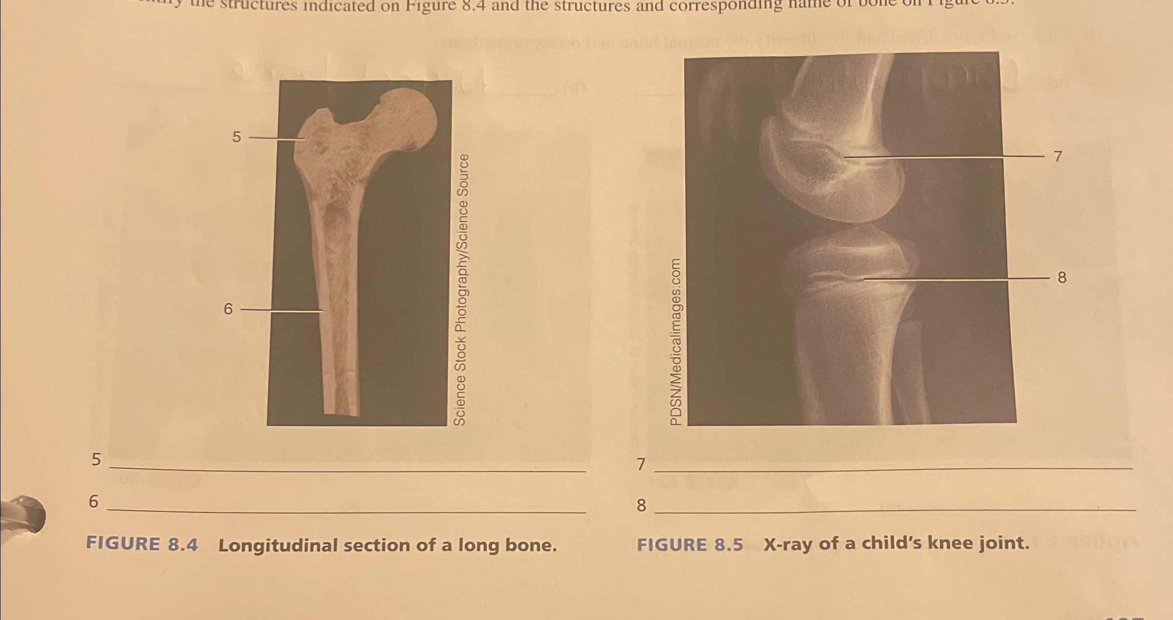 Solved 5 q,6 q,FIGURE 8.4 ﻿Longitudinal section of a long | Chegg.com