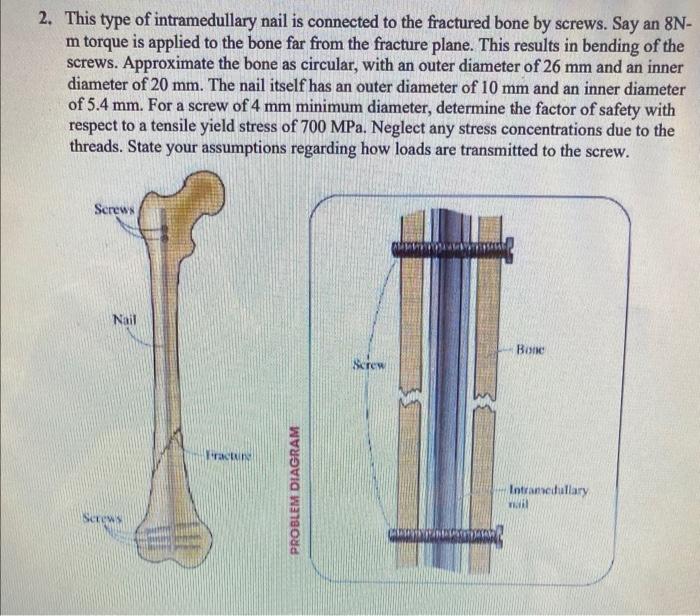 Solved 2. This type of intramedullary nail is connected to | Chegg.com