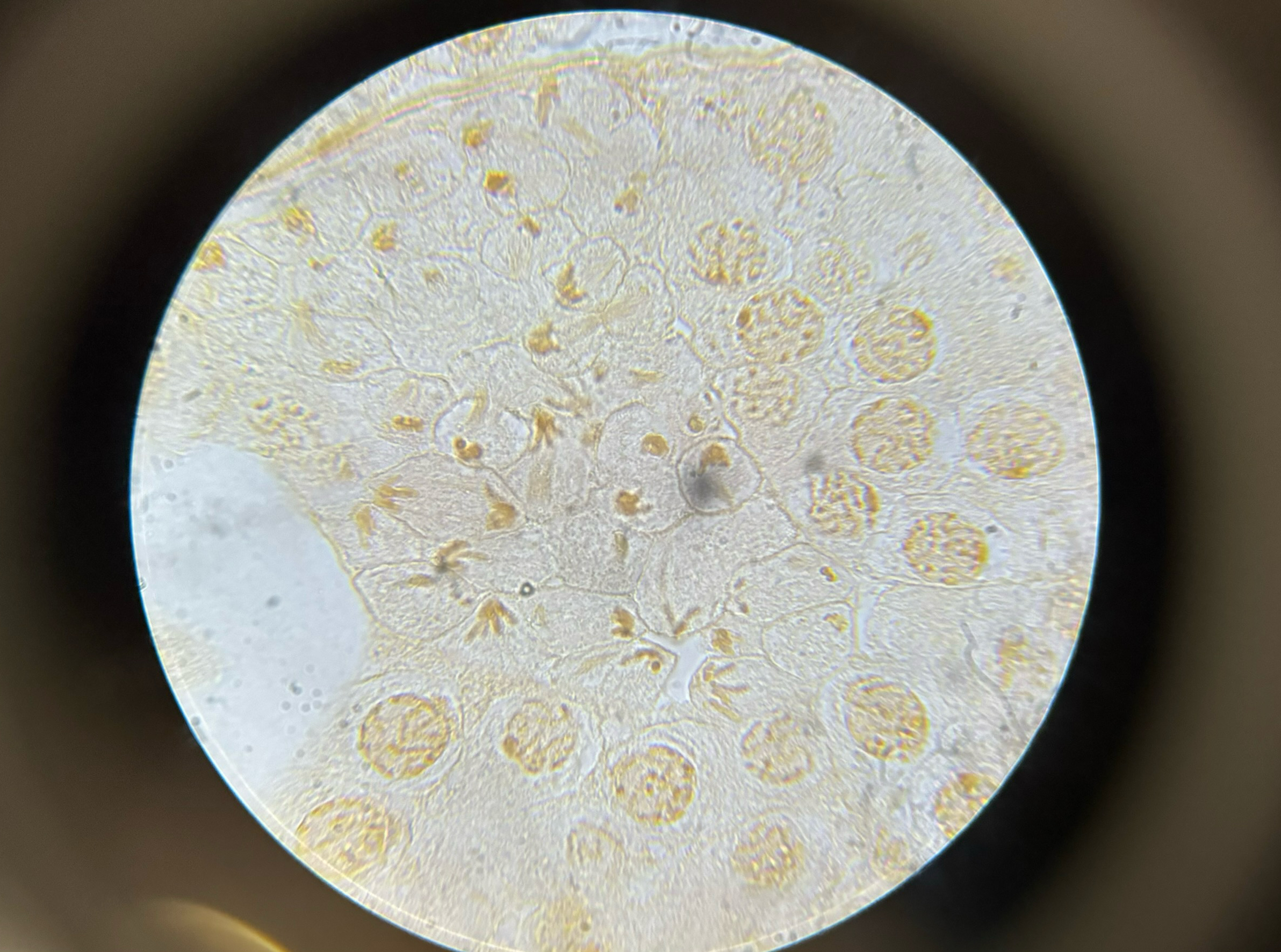 Label the meiosis I and meiosis II observed in this | Chegg.com