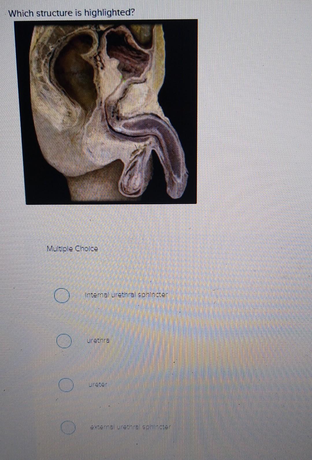 Solved Which structure is highlighted? Multiple Cholce ntema | Chegg.com