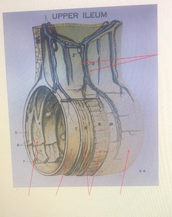 Solved UPPER ILEUM 10 X5 tattet JF JUNUM | Chegg.com