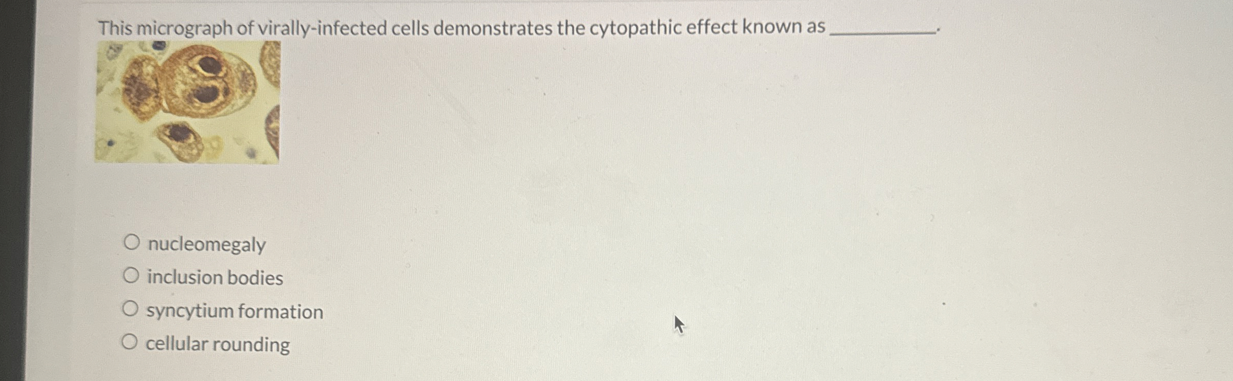 Solved This micrograph of virally-infected cells | Chegg.com