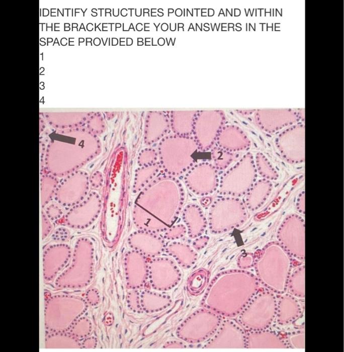 Solved IDENTIFY STRUCTURES POINTED AND WITHIN THE | Chegg.com