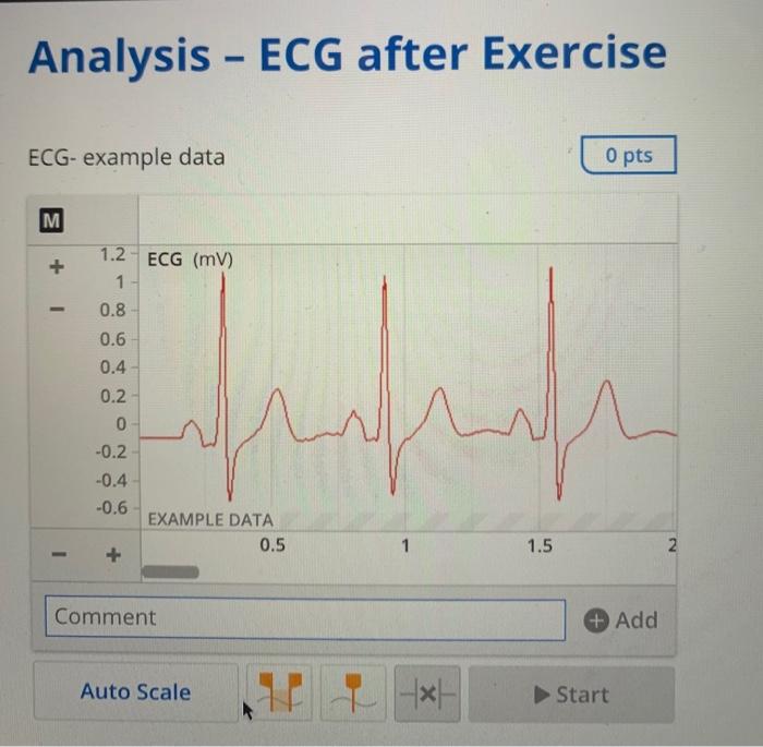 Solved Exercise 2: ECG after exercise ECG-example data O pts | Chegg.com