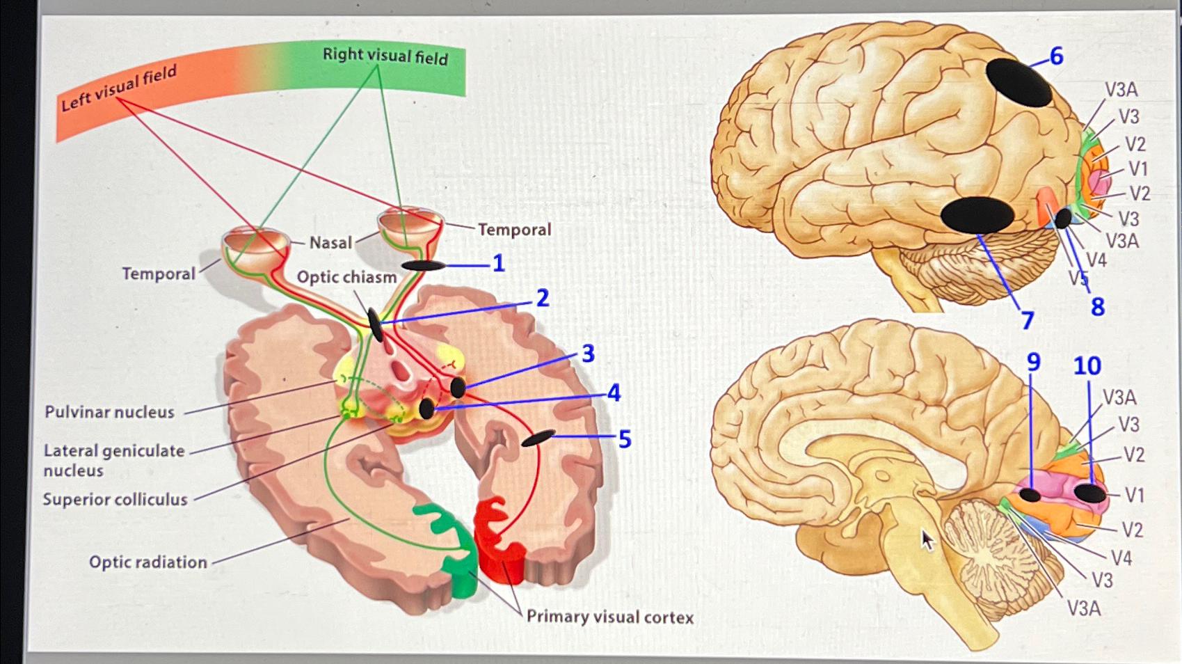 Solved What are labels 1-10? | Chegg.com