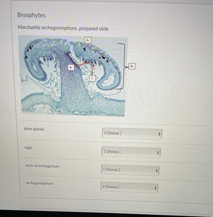 Solved Bryophytes Marchantia archegoniophore, prepared slide | Chegg.com