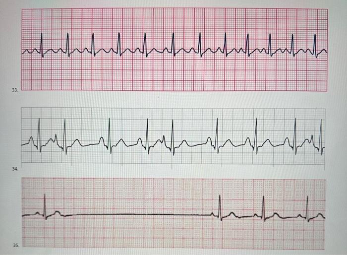 - The underlying rhythm name is appropriately | Chegg.com