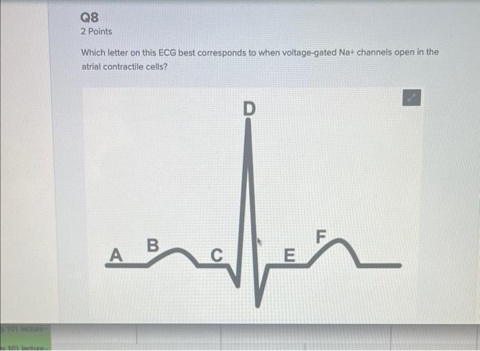 Solved Which letter on this ECG best corresponds to when | Chegg.com