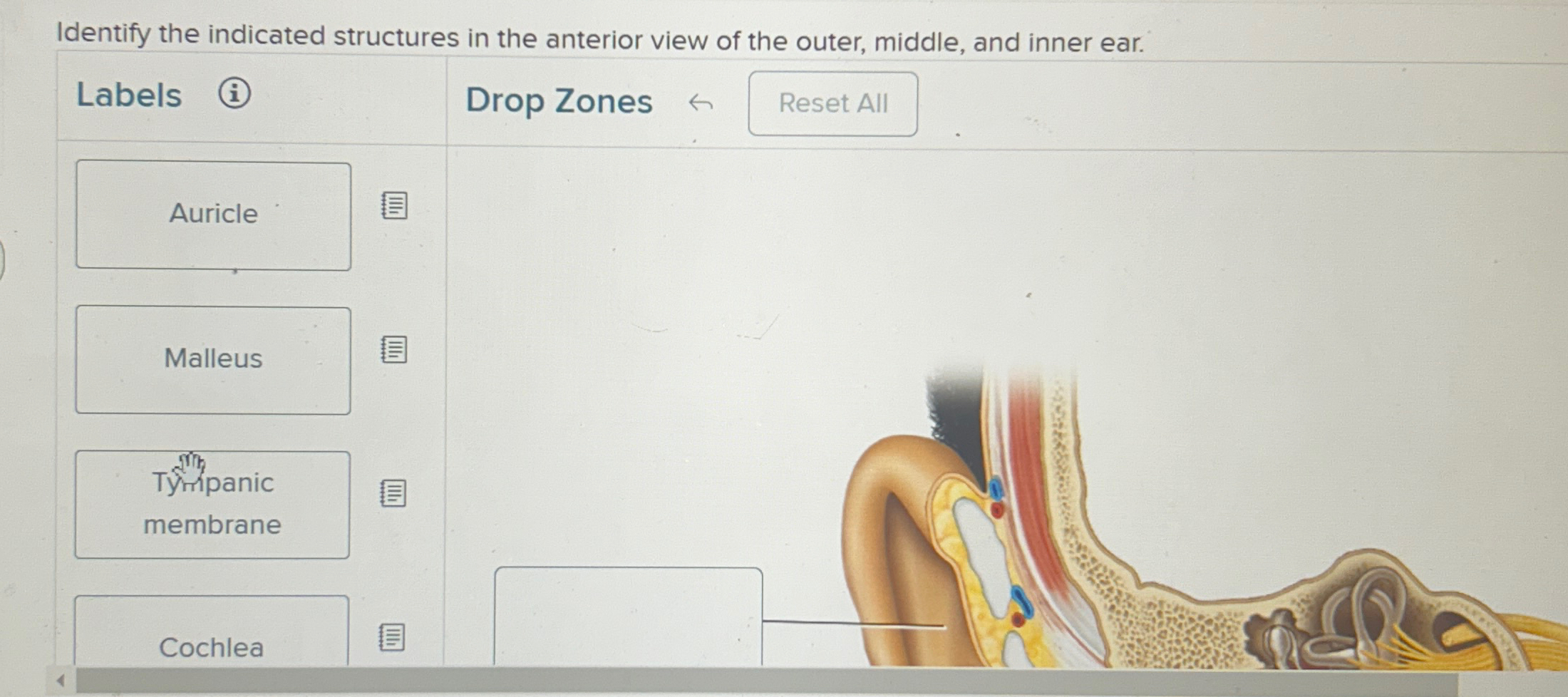 Solved Identify the indicated structures in the anterior | Chegg.com
