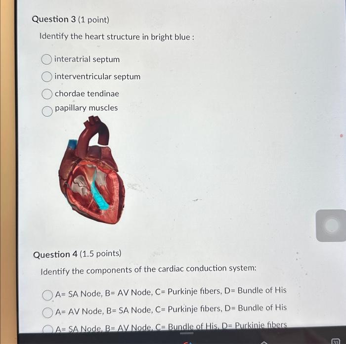 Solved Identify the heart structure in bright blue: | Chegg.com
