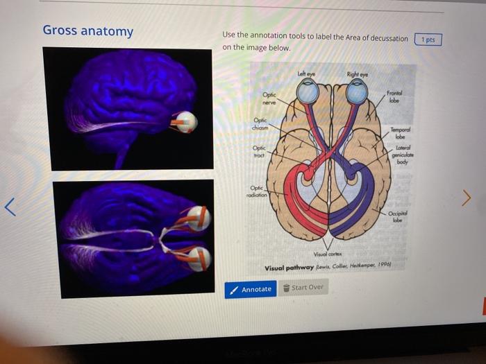 Solved Gross anatomy Use the annotation tools to label the | Chegg.com