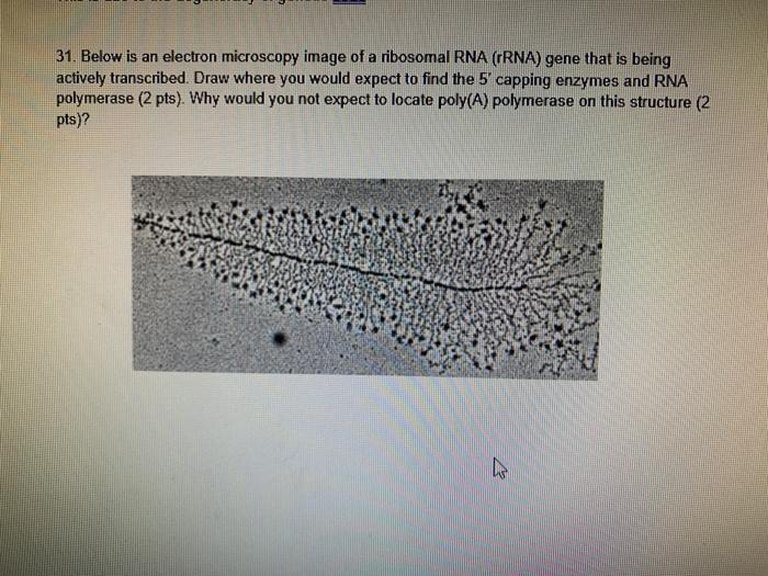 Solved 31. Below is an electron microscopy image of a | Chegg.com