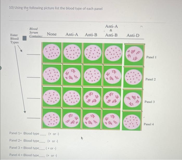 Solved 10) Using the following picture list the blood type | Chegg.com