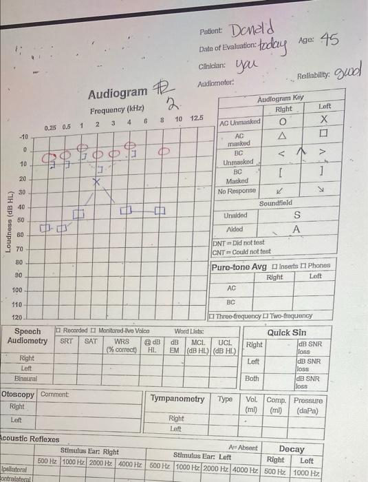 Solved Interpret the audiogram. A. The bone conduction | Chegg.com