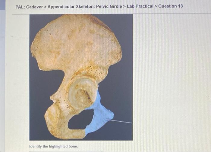 Solved PAL: Cadaver > Appendicular Skeleton: Pelvic Girdle > | Chegg.com