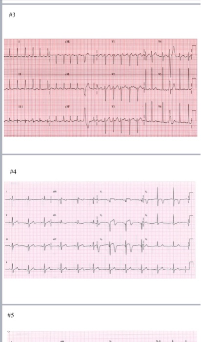 Solved Assignment Template • Rate • Rhythm and Intervals • | Chegg.com