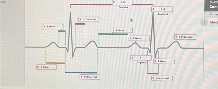 Solved abels X P Wave X Q Wave X Q-T Interval X P-R Interval | Chegg.com
