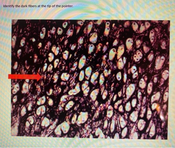 Solved Identify the dark fibers at the tip of the pointer. | Chegg.com
