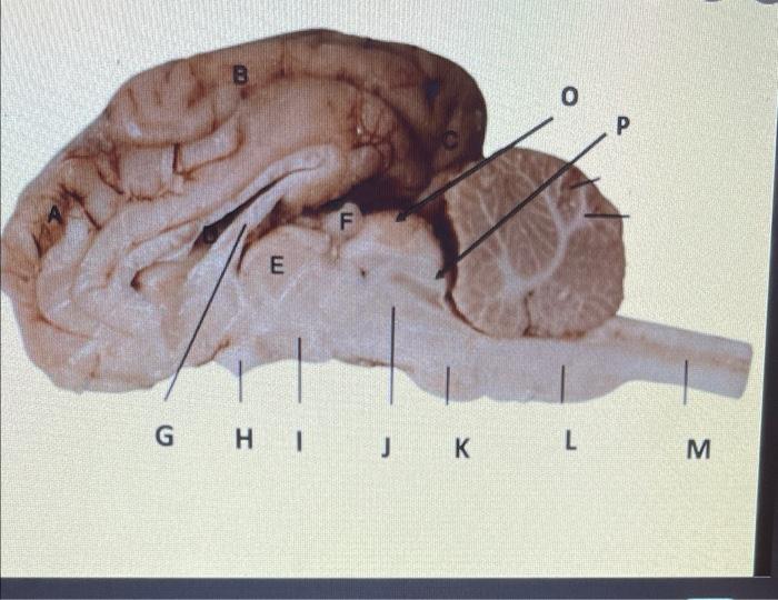 Sheep Brain Sagittal View