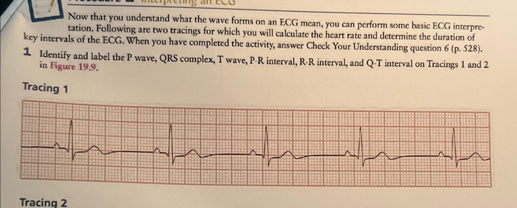 Now that you understand what the wave forms on an ECG | Chegg.com