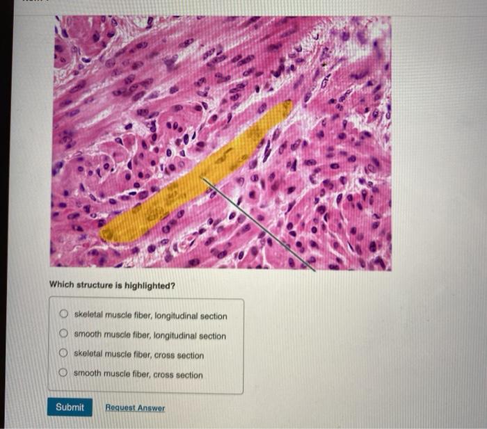Solved Which structure is highlighted? O skeletal muscle | Chegg.com