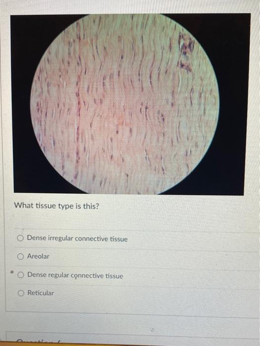 Solved What tissue type is this? O Dense irregular | Chegg.com