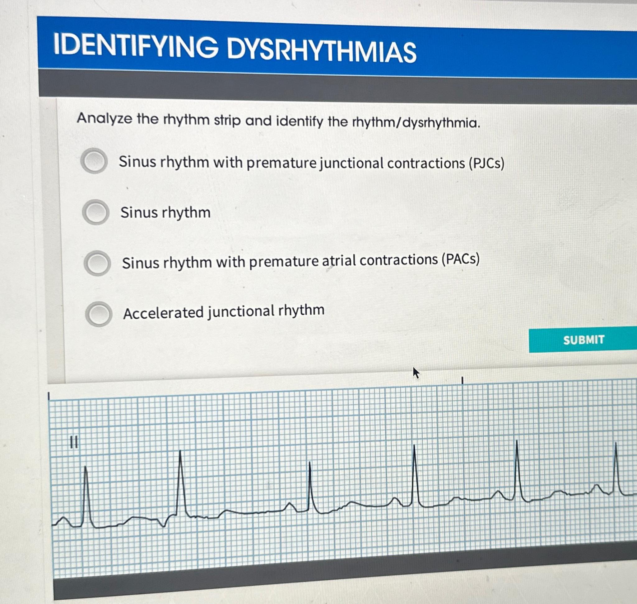 Solved IDENTIFYING DYSRHYTHMIASAnalyze the rhythm strip and | Chegg.com