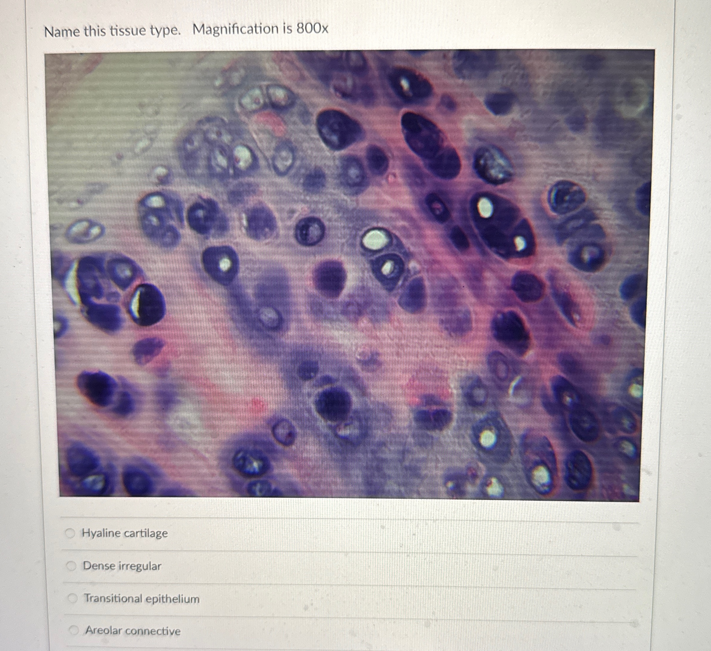 Solved Name this tissue type. Magnification is 800xHyaline | Chegg.com