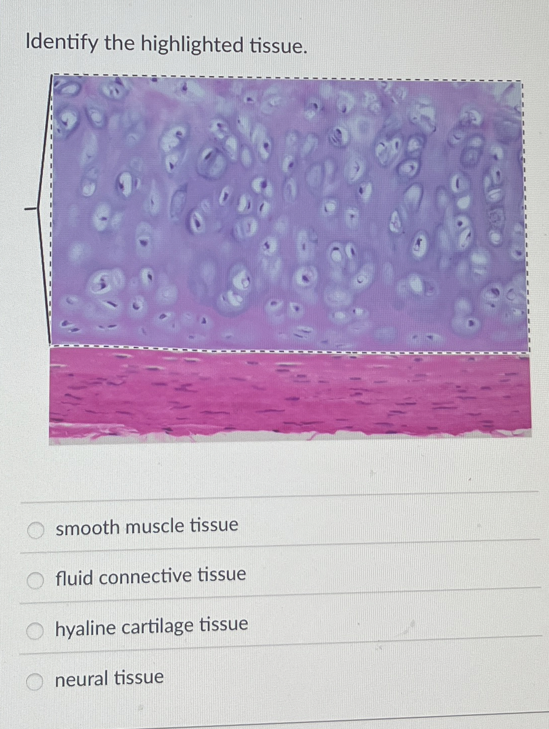 Solved Identify the highlighted tissue.smooth muscle | Chegg.com