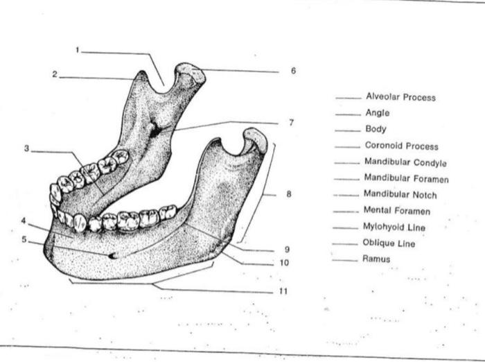 Solved Alveolar Process Angle Body Coronoid Process | Chegg.com