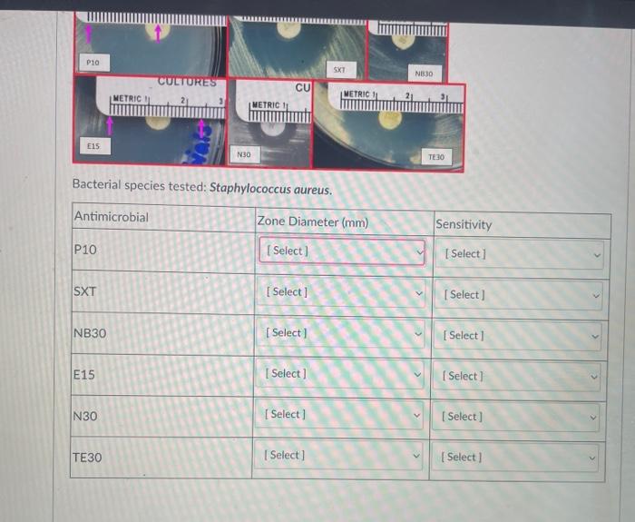 Solved Using the metric ruler, measure the Zone of | Chegg.com